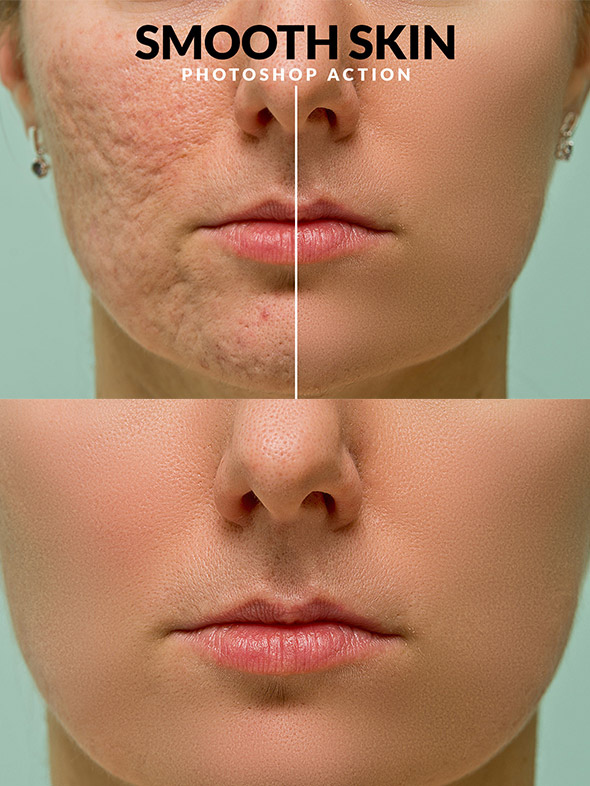 Skin Graphics, Designs & Templates from GraphicRiver