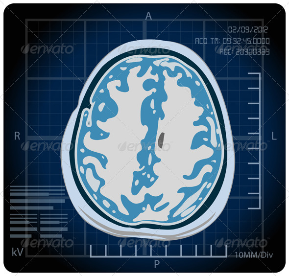 Mri Graphics, Designs & Templates | GraphicRiver